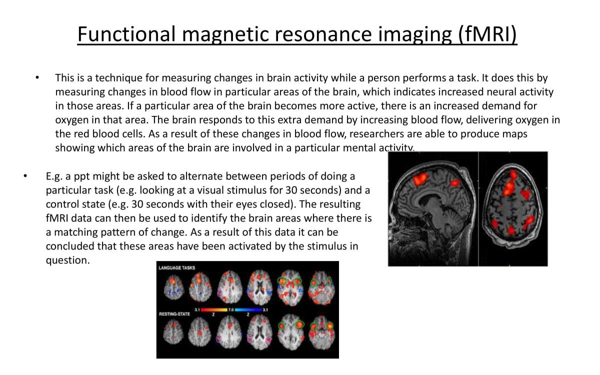 Fmri Scan Psychology